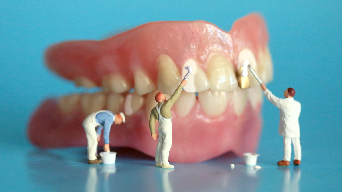 Professional Teeth Whitening | Dawood & Tanner | Enhance Your Smile